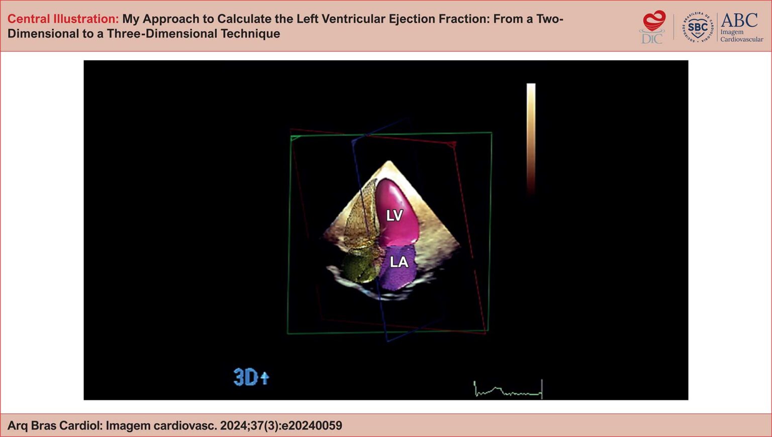 My Approach to Calculate the Left Ventricular Ejection Fraction: From a ...