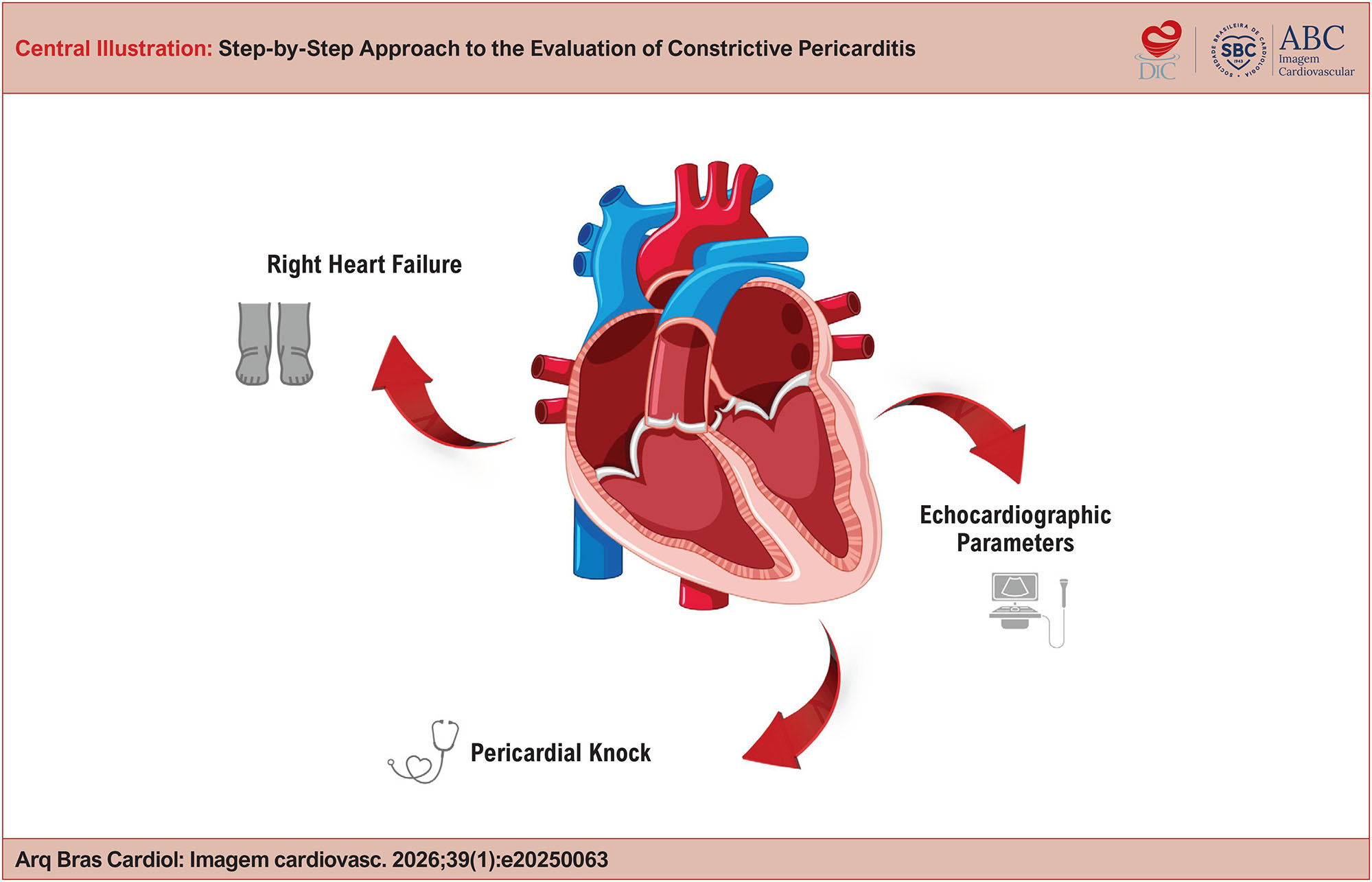 Step-by-Step Approach to the Evaluation of Constrictive Pericarditis ...